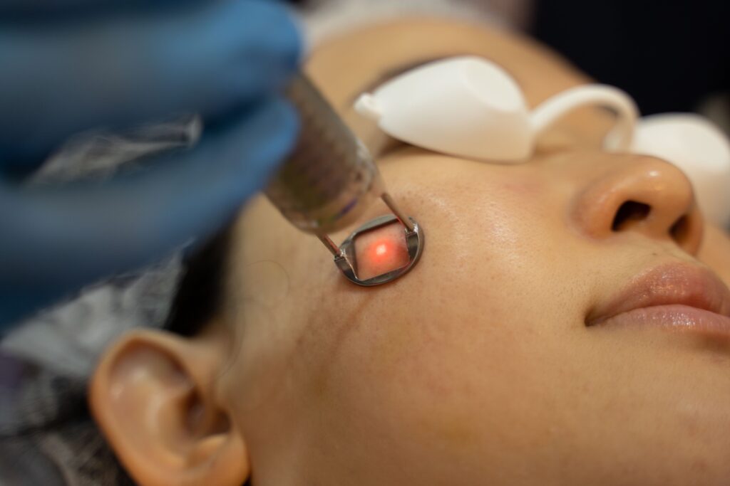 Apakah Itu Rawatan Pico Laser? - Klinik Avicenna